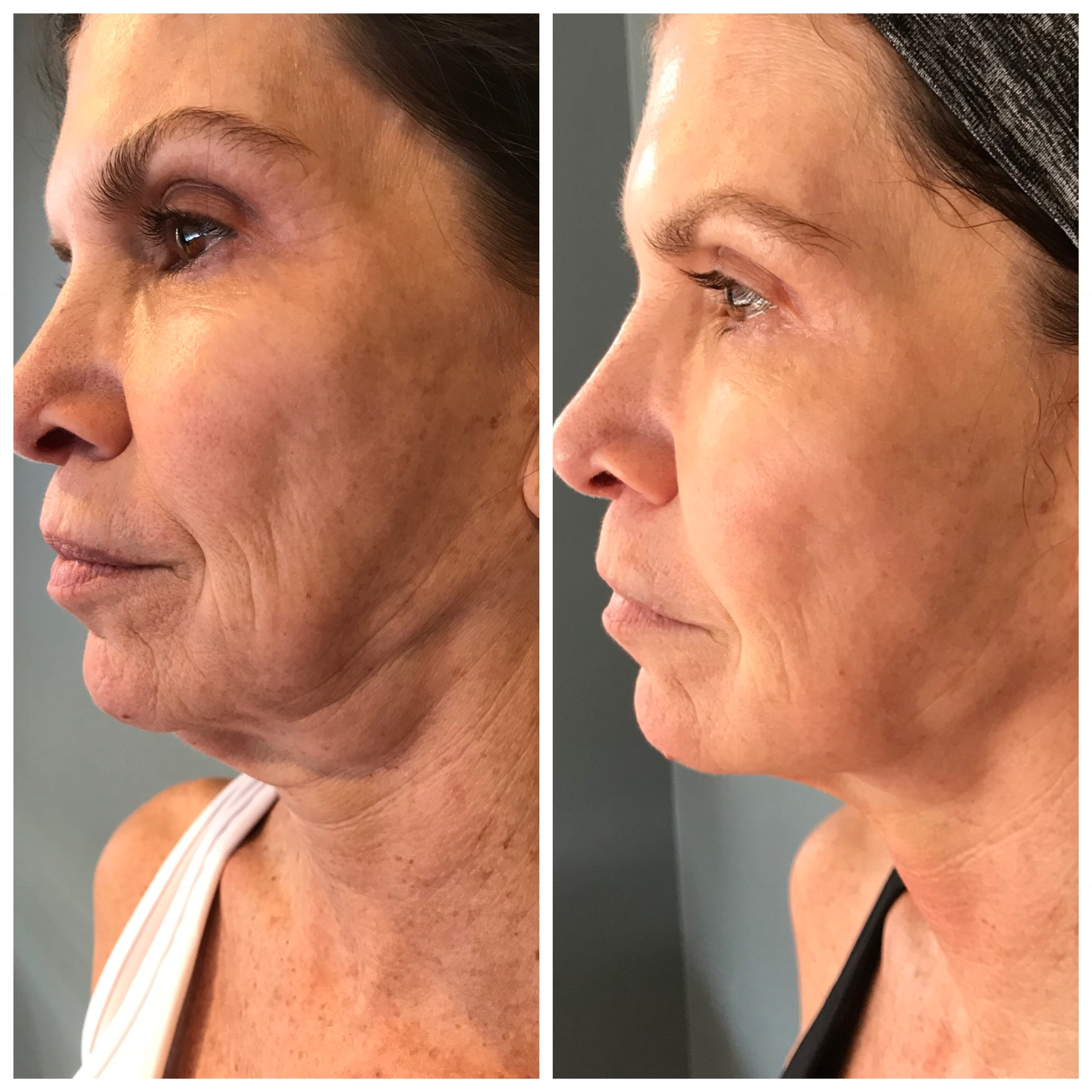 Benefits of Cryo Toning at Orange Cryo Wellness in Conshohocken ...